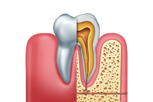 What Is Root Resorption? | Edmond, OK | Contemporary Endo